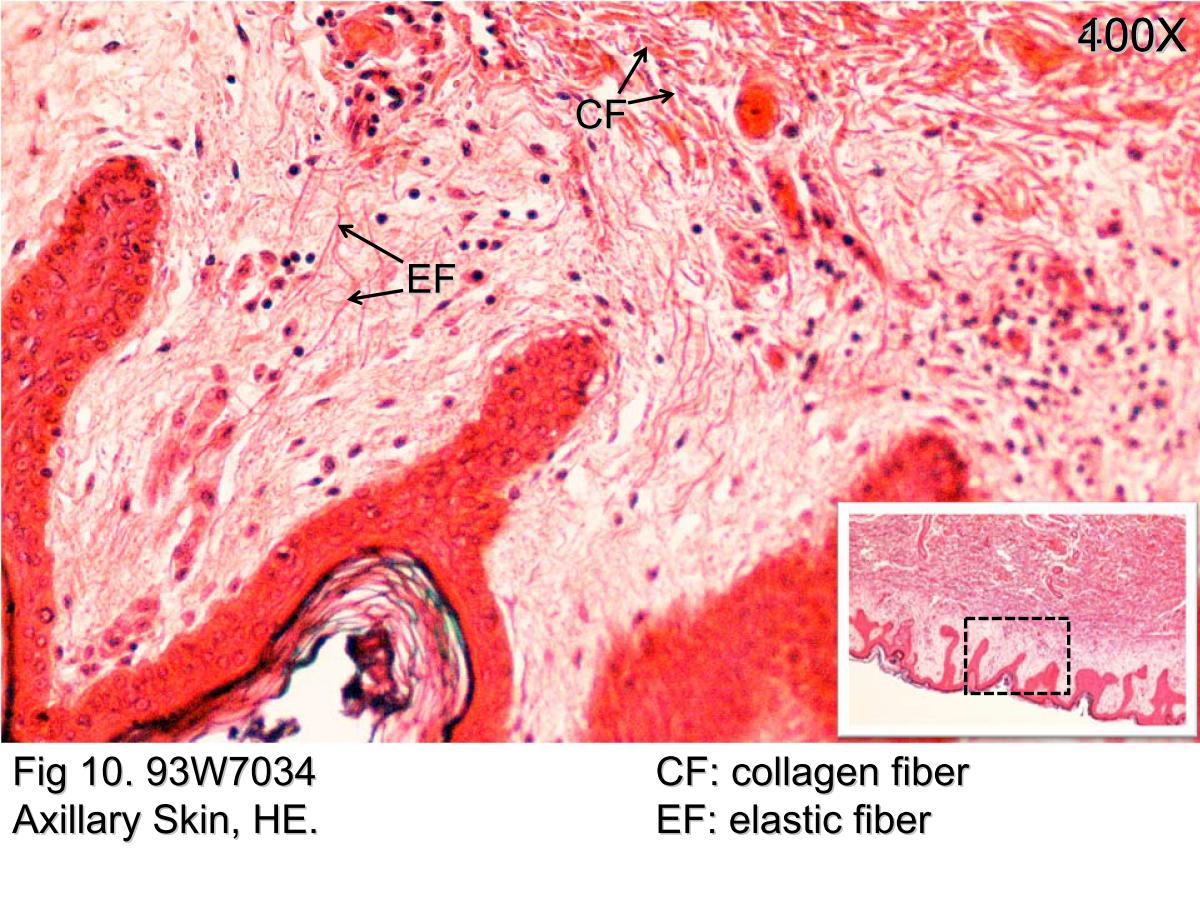 Block1 Fig 10 Dermis Of Thick Skin