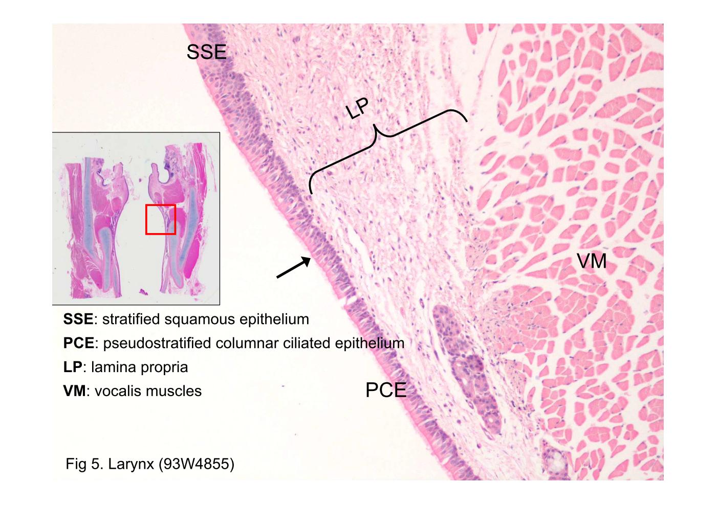 Block4 Fig 5 Larynx 93W4855 