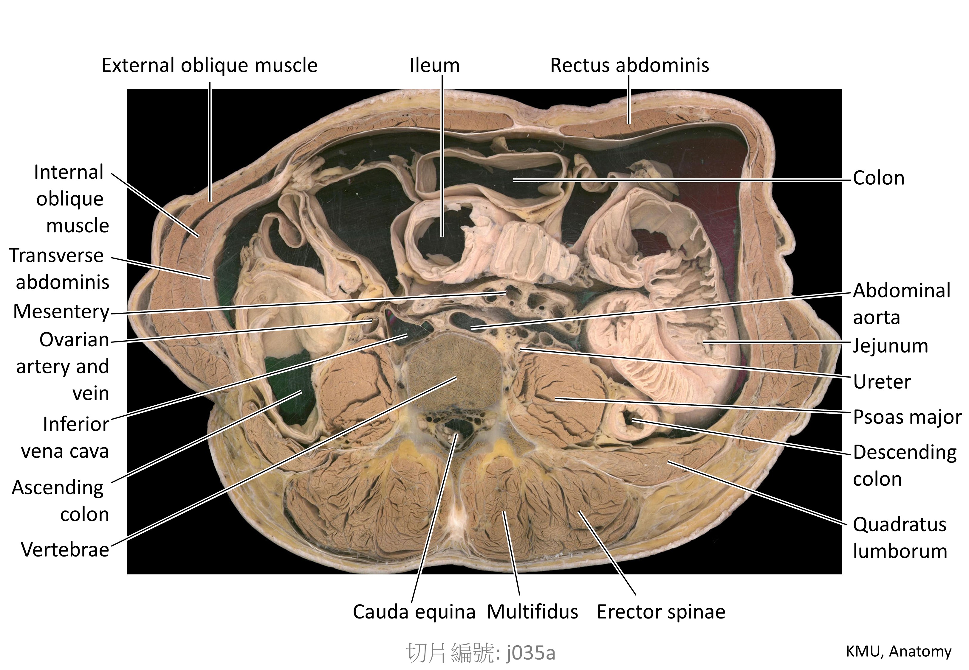 KMU Anatomy Sections