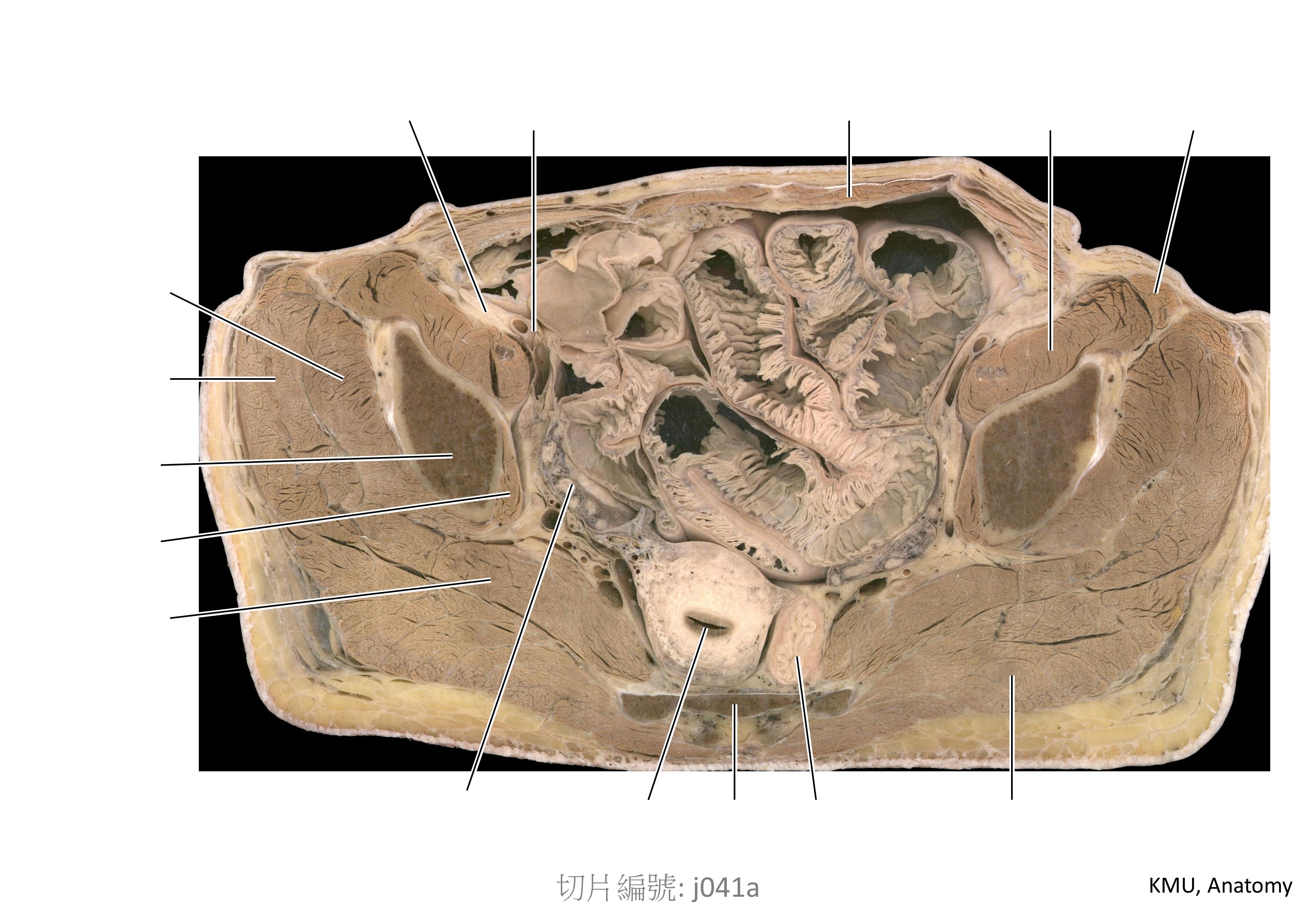 KMU Anatomy Sections
