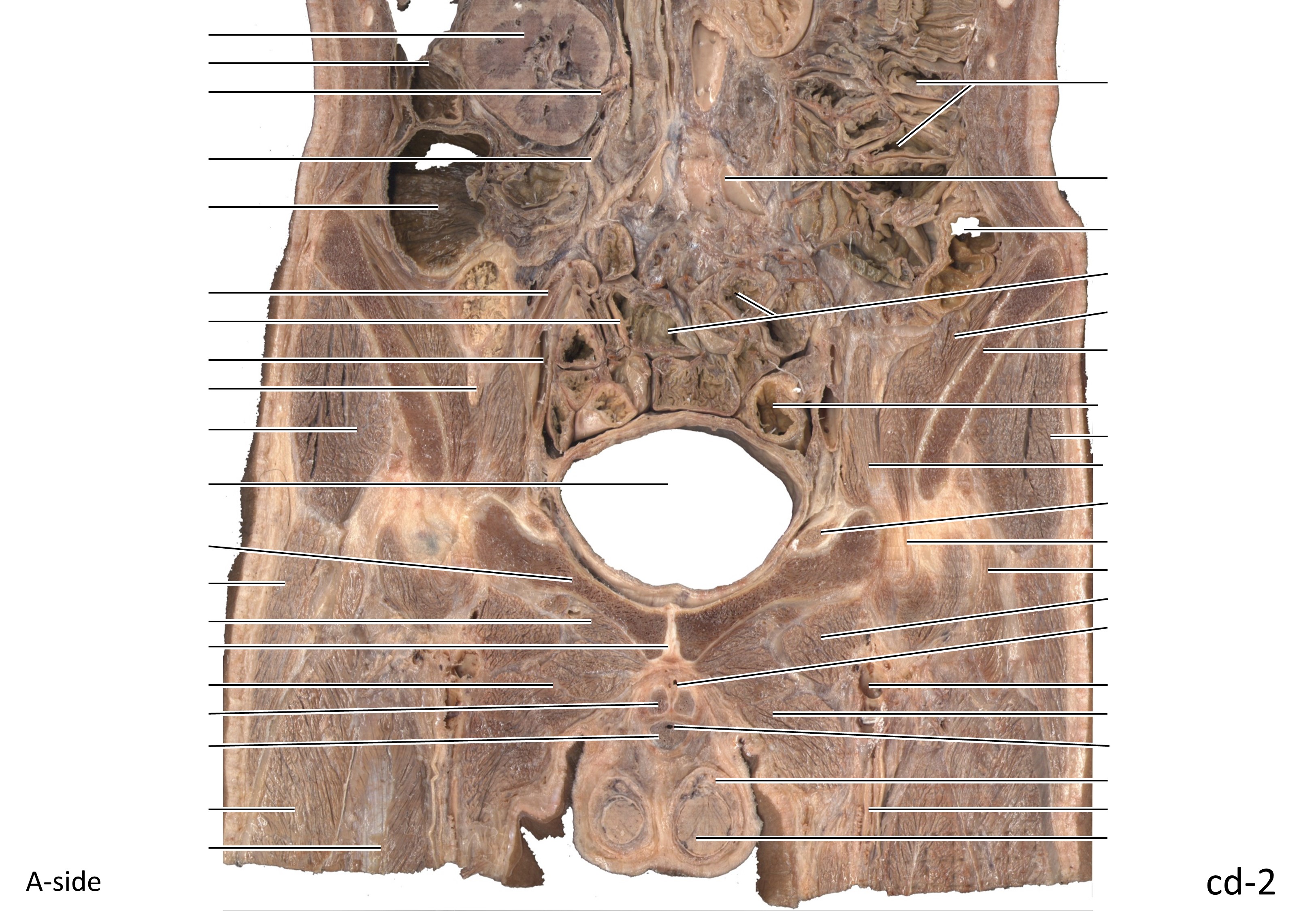 KMU Anatomy Sections