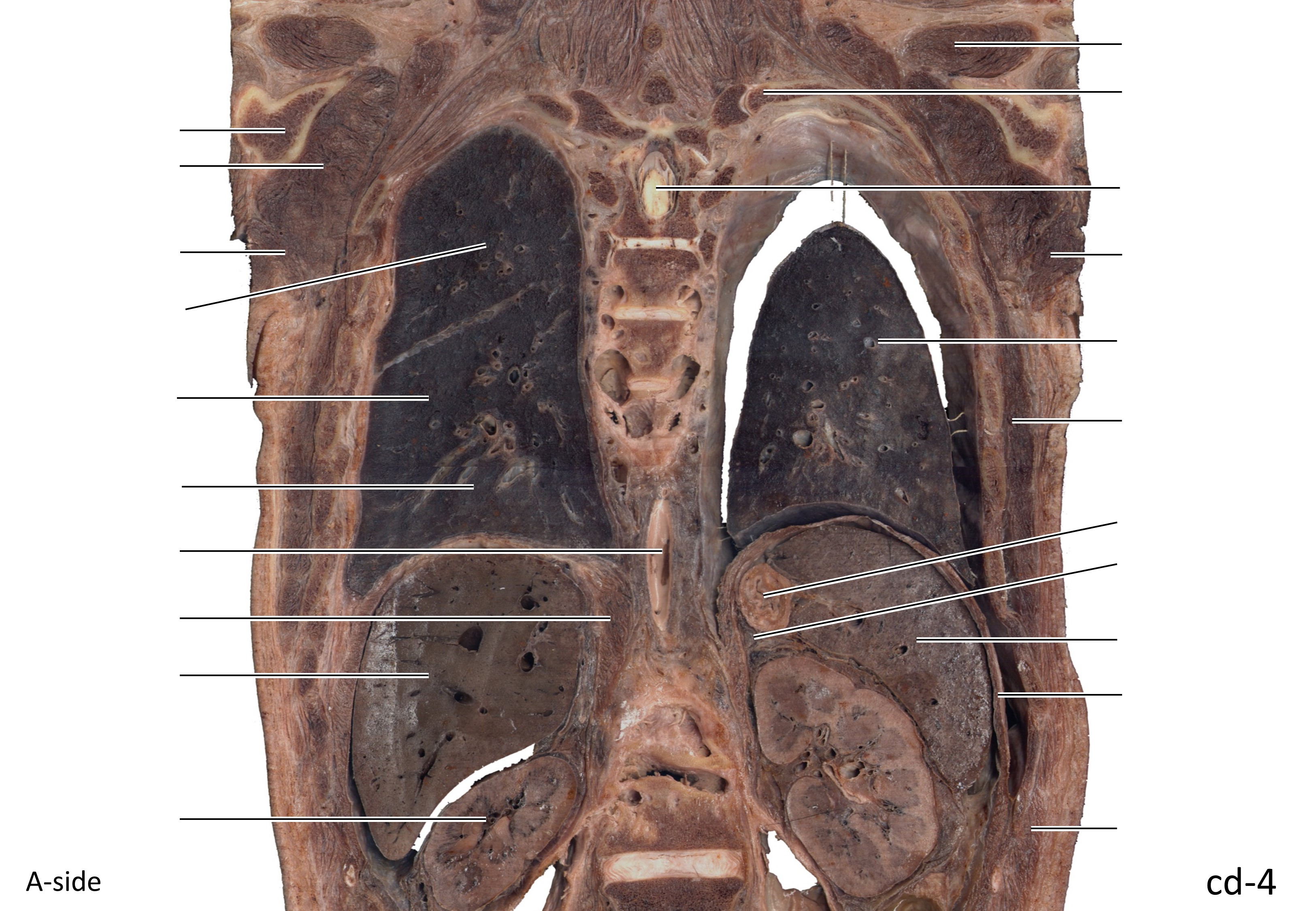 KMU Anatomy Sections