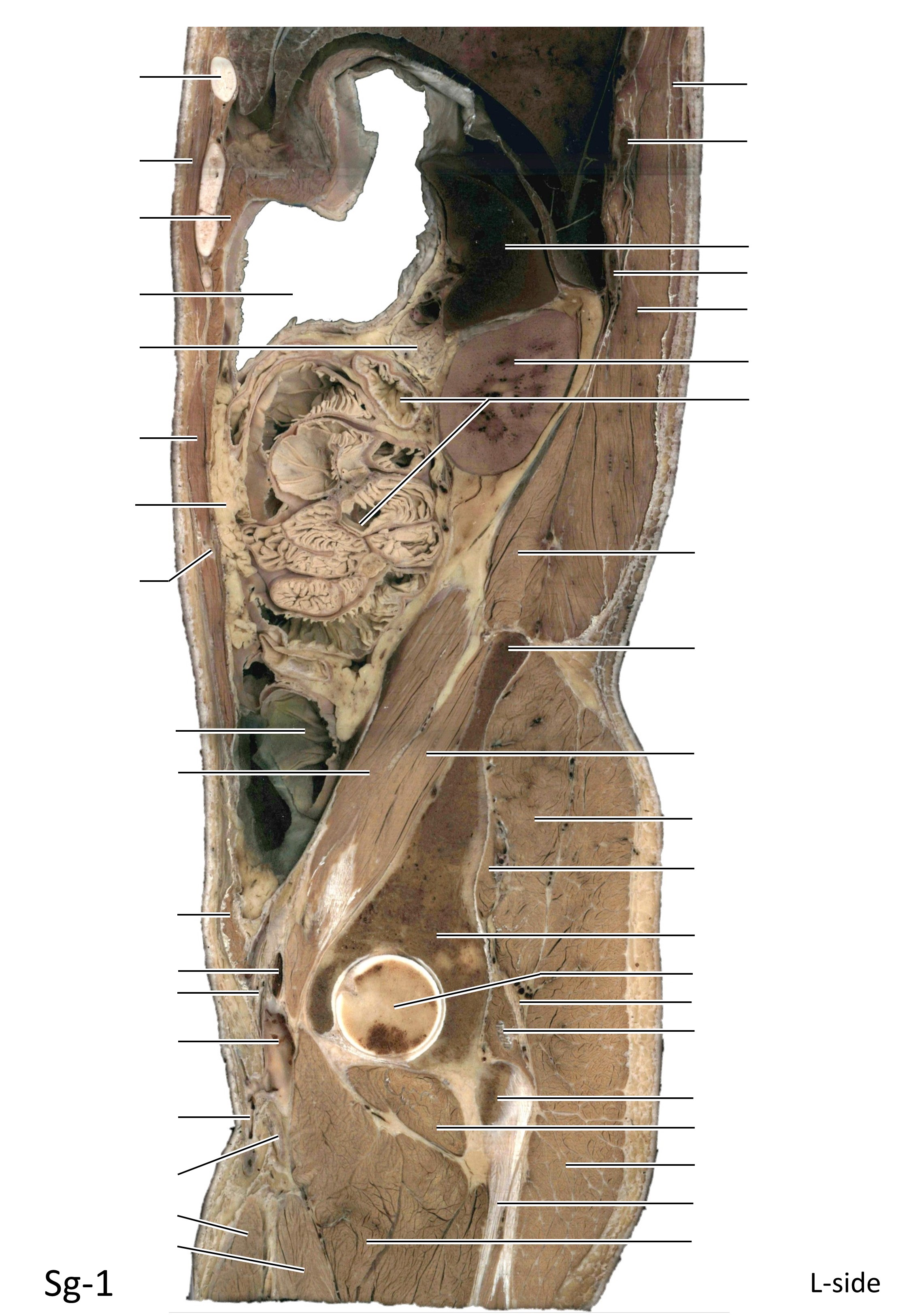 KMU Anatomy Sections