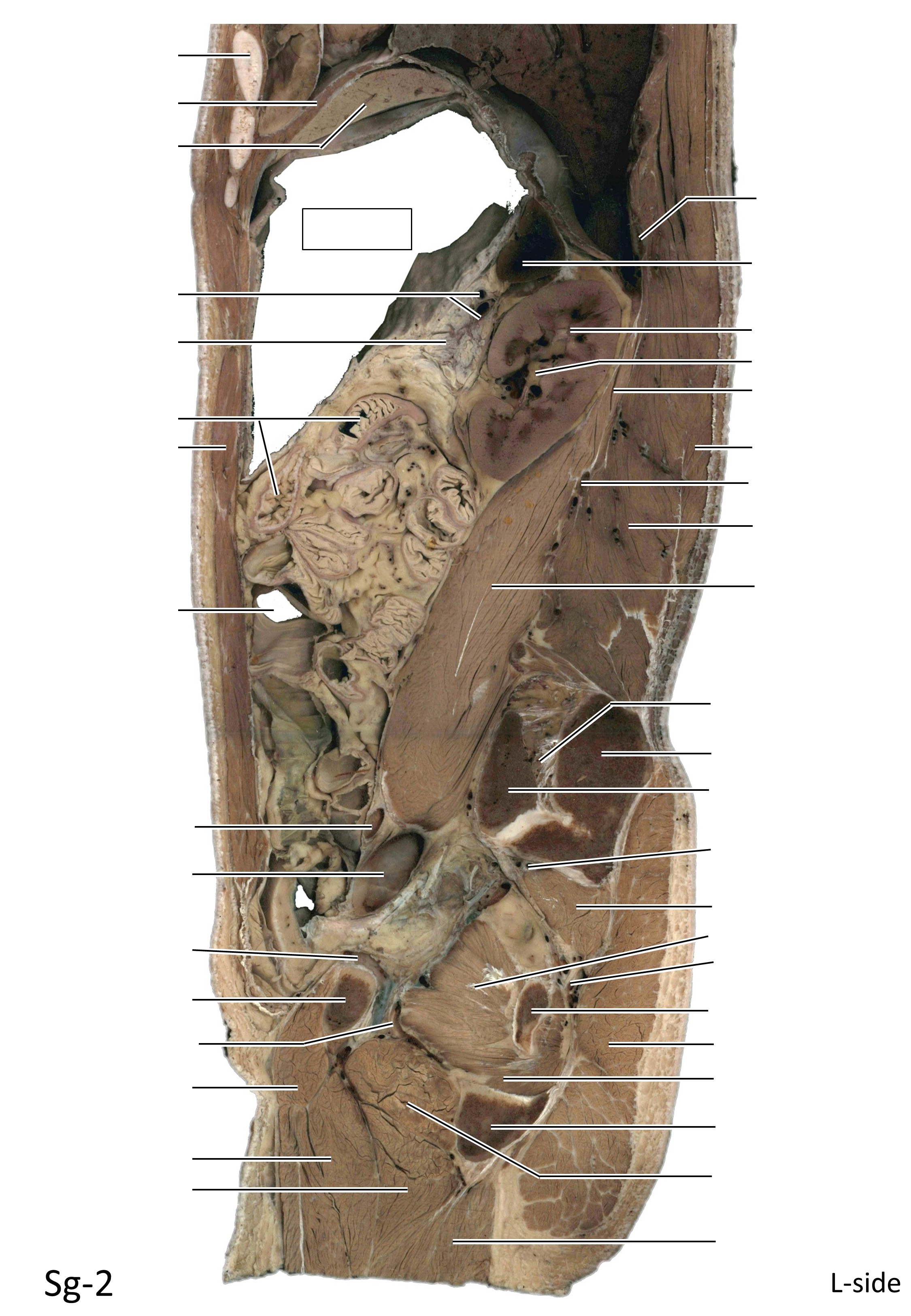 KMU Anatomy Sections