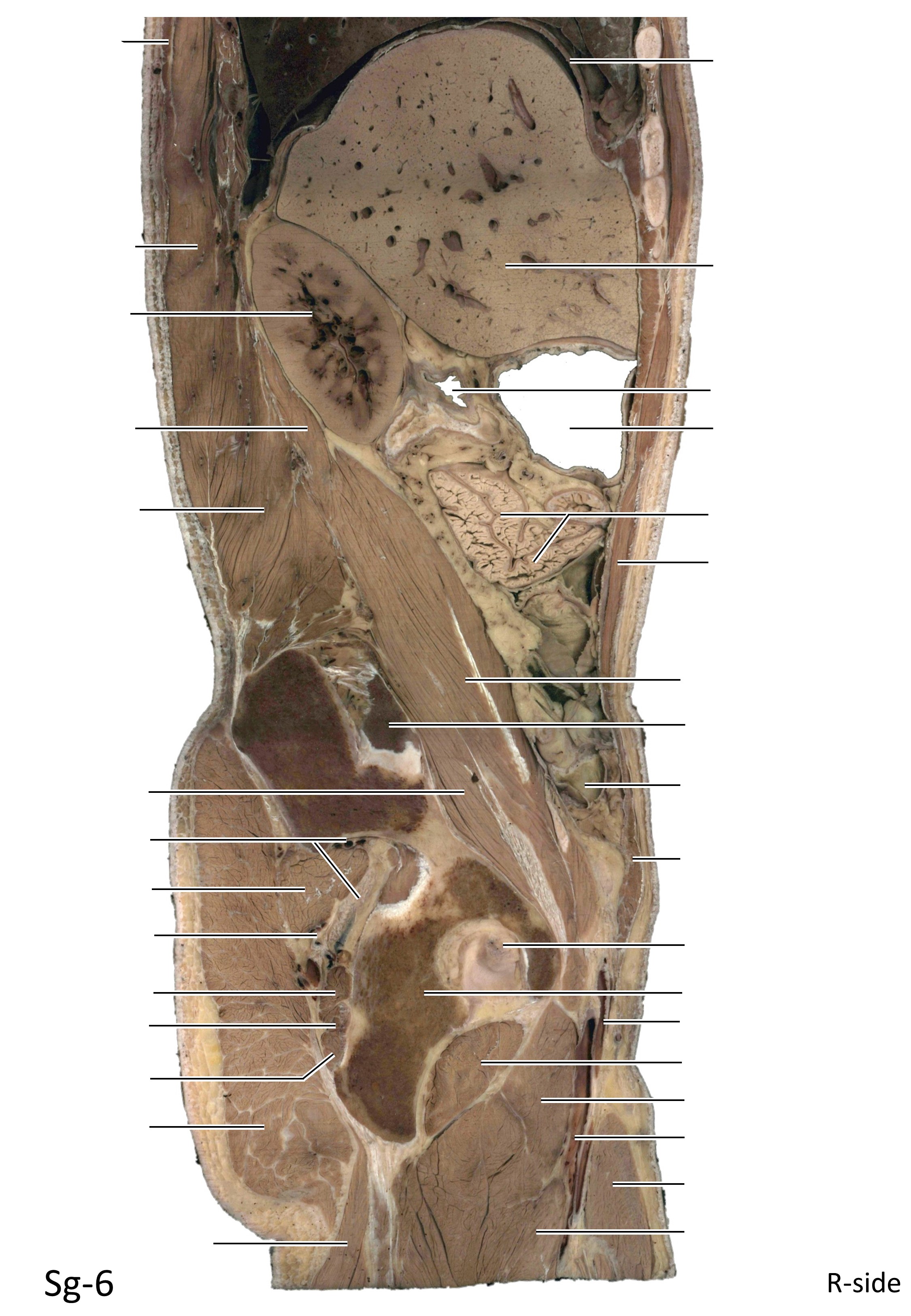 KMU Anatomy Sections